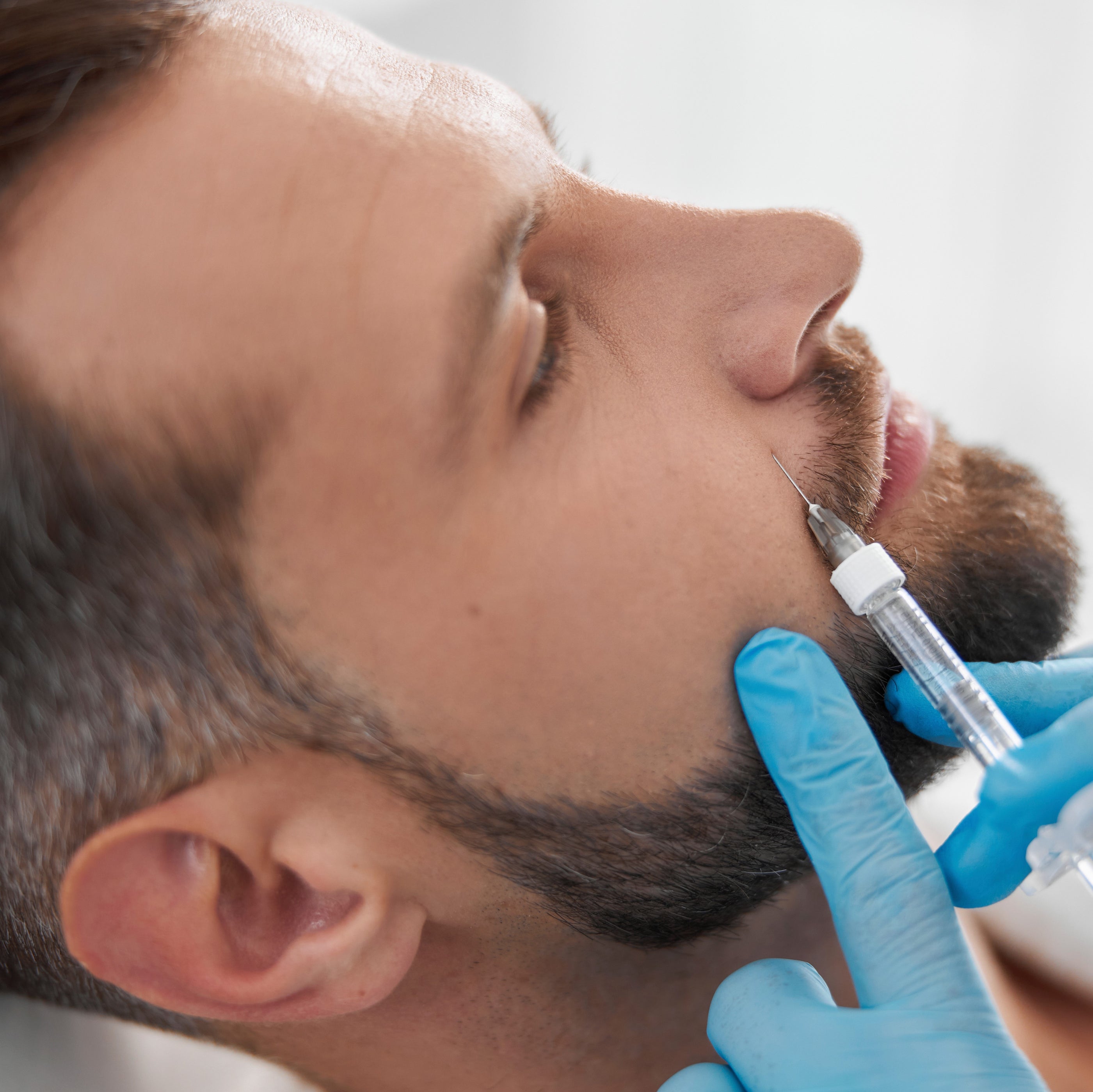 Naso-Labial Fold Fillers — SKINVIEW MEDICAL AESTHETICS