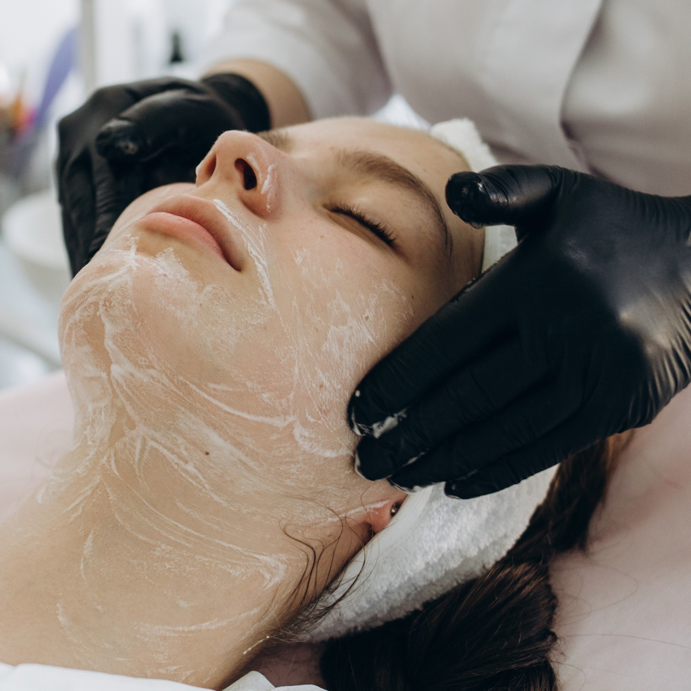 Depigmentation (Cosmelan) — SKINVIEW MEDICAL AESTHETICS